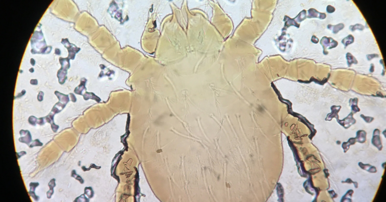10 Examples of Mites That Bite Humans and Pets