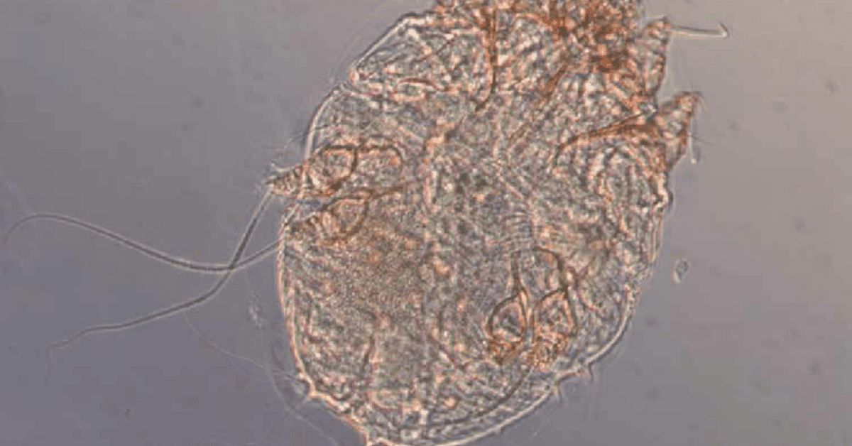 10 Examples of Mites That Bite Humans and Pets